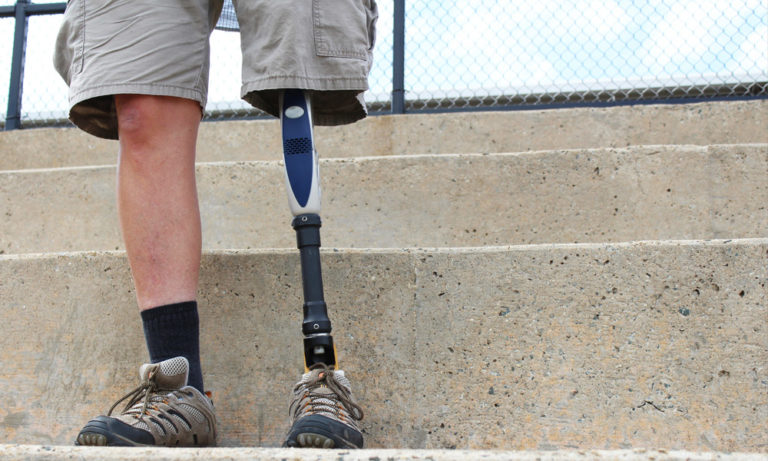 How serious is PAD (Peripheral Arterial Disease) and who is affected?